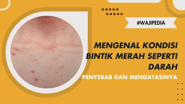 Bintik Merah Seperti Darah Dibawah Kulit: Penyebab dan Mengatasinya