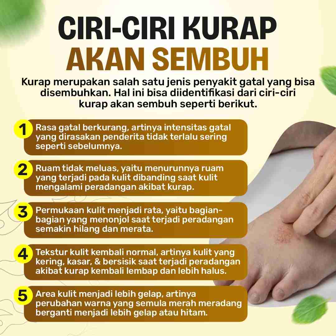 5 Ciri Ciri Kurap Akan Sembuh dan Bisakah Sembuh dengan Sendirinya?
